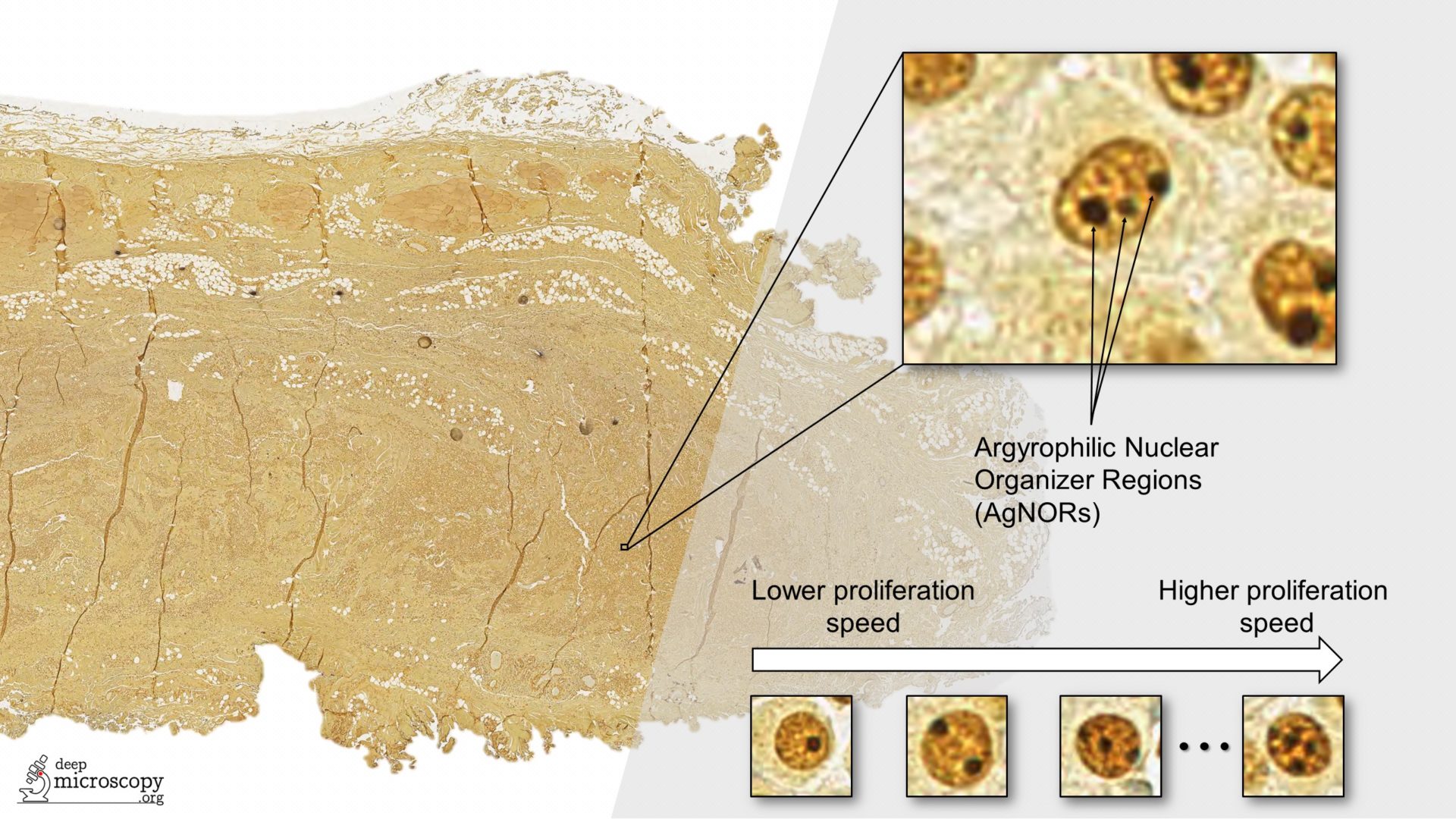 Deep Learning-based Automatic Assessment of AgNOR-Scores, measuring ...
