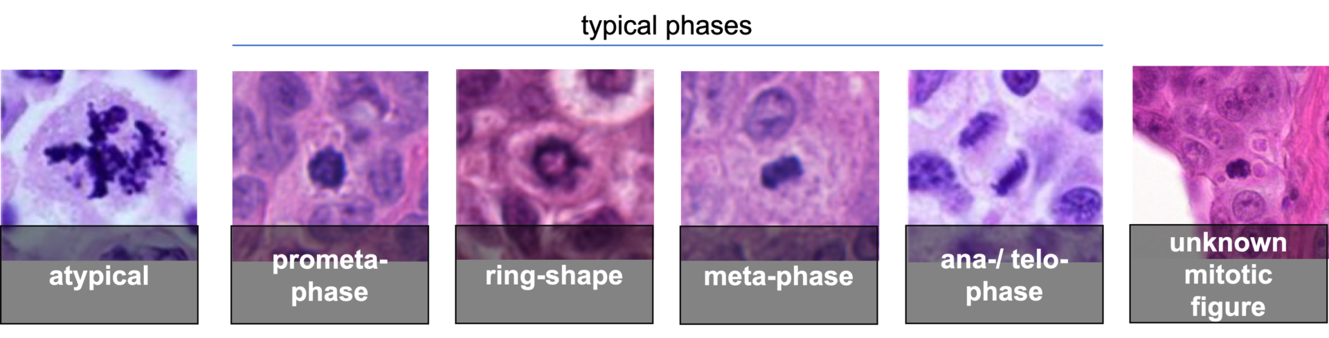 Detection of Atypical Mitotic Figures [BVM2023 Talk] – deepmicroscopy.org